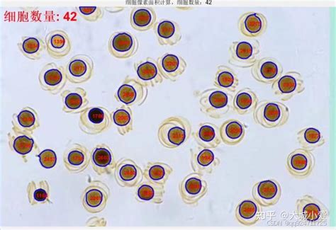 基于matlab程序细胞计数和面积计算 使用形态学的方法，可以对细胞图像进行处理。 知乎