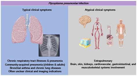 Causes Of Atypical Pneumonia In Adults