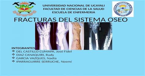Fracturas Del Sistema Óseo [pptx Powerpoint]