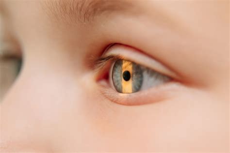 Sensorimotor Exam For Vision Coordination Prosper Family Eyecare Prosper TX