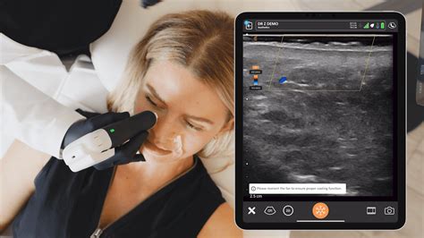 Pyriform Fossa Mapping And Injections Clarius