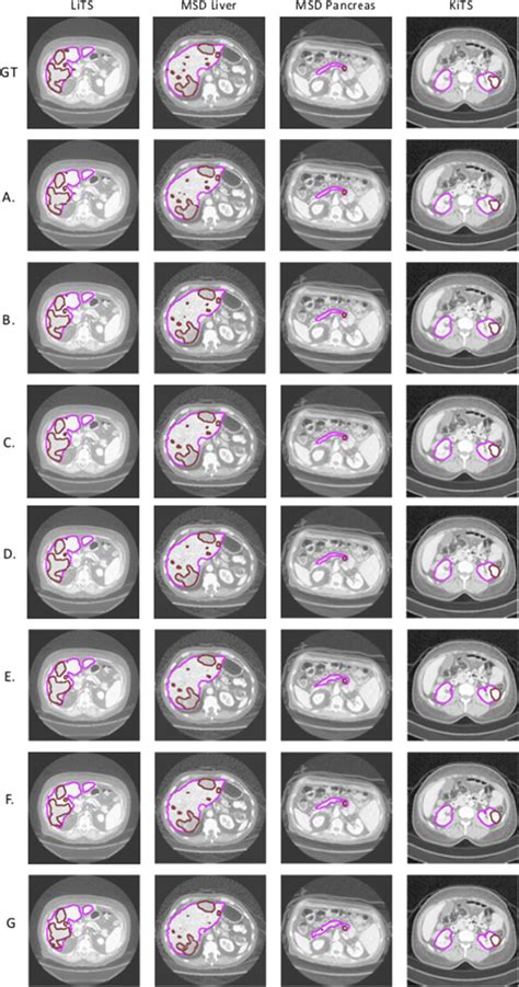 Example Segmentation Results Of Different Methods From The Four Download Scientific Diagram