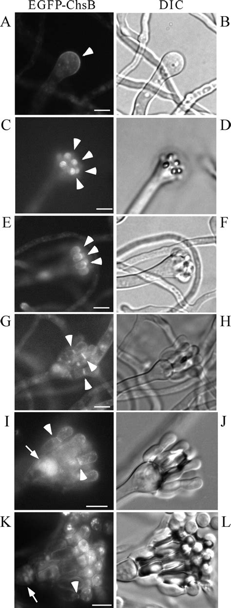 Class Iii Chitin Synthase Chsb Of Aspergillus Nidulans Localizes At The