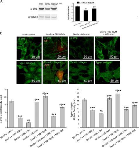 Fibroblast Myofibroblast Transition After Exposure To Msc Conditioned Download Scientific