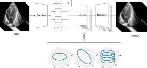 Figure From Anomaly Detection In Echocardiograms With Dynamic Variational Trajectory Models