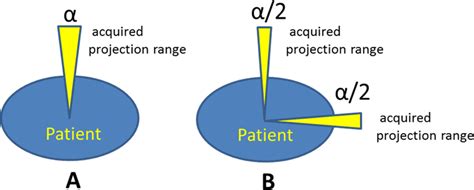 A The Single View Dts That Is Reconstructed By Limited Angle
