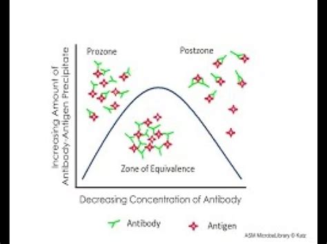 Prozone Phenomenon And Postzone Phenomenon Zone Of Equivalence In