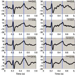 Raw Human MCG Signals Simultaneously Recorded By The Channel OPM Download Scientific