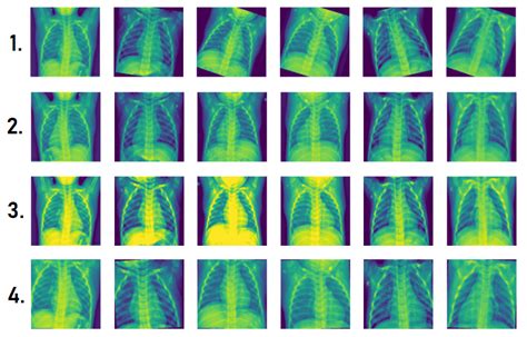 Transformations For Augmentation Download Scientific Diagram