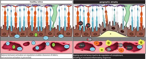 Complement Regulation In The Retina In The Healthy Retina Presence Of Download Scientific