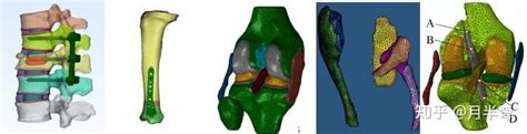 最新mimics三维建模 3 Matic 骨科生物力学仿真应用 知乎