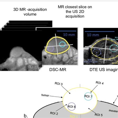 Schematic Of Data Segmentation And Roi Delimitation A Mr Data Download Scientific Diagram