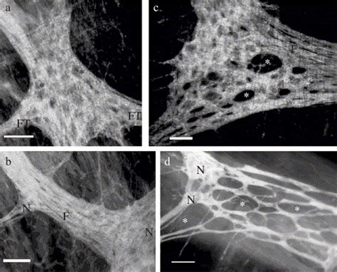 Age Related Changes In The Morphology Of The Myenteric Plexus Of The Human Colon Autonomic