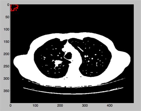 Python Setting Position Of Contour Sub Plot In Matplotlib Stack