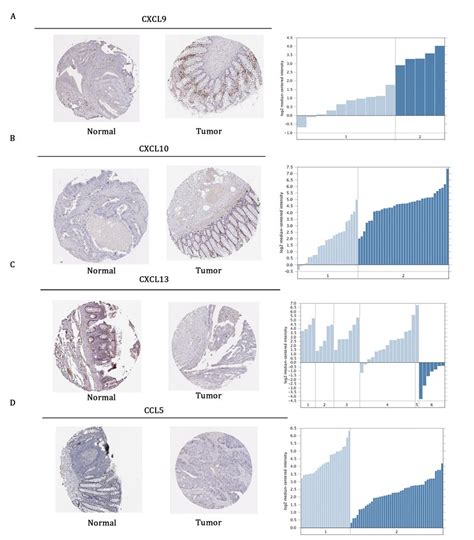 Gene Expression In Human Rectal Cancer Specimens Four Genes Expression Download Scientific