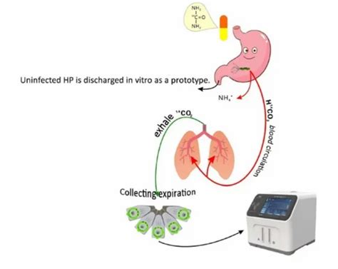 Helicobacter Pylori Detector Breath Test Urea Breath Test C14 Machine