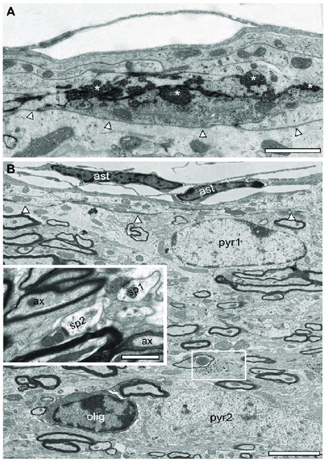 Structural Organization Of The Adult Reeler Mouse Neocortex Download Scientific Diagram