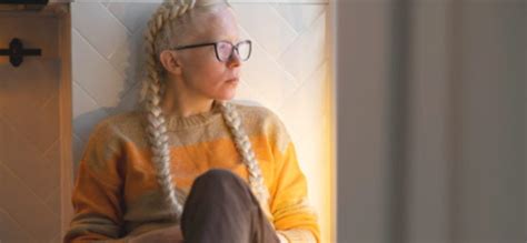 Albinism Insights Types Of Albinism Causes And Symptoms
