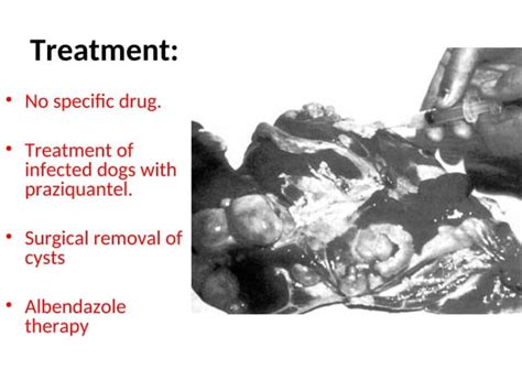 Echinococcus Lecppt For Every Science Students Ppt
