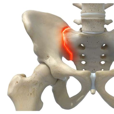 For Patients Cornerloc™