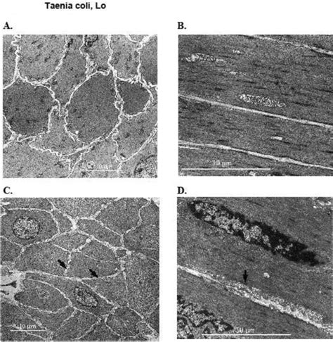 Taenia Coli