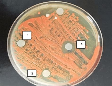 Zone Of Inhibition Of The Effect Of Tam On Cryptococcus Laurentii A