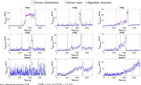 Table 3 From Seizure Detection Based On Vagus Nerve Activity Translation To An Implantable