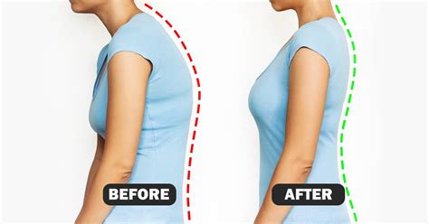 Top5 Posture Correctors Her Beauty Review