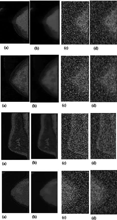 1 Visual Results Comparison Of Various Restoration Methods A Poisson