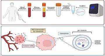 Exosome Based Liquid Biopsy Approaches In Bone And Soft Tissue Sarcomas