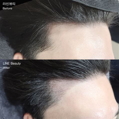 라인피부과 반영구화장센터 라인뷰티