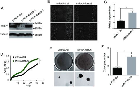Rab26 Knockdown Promotes Migration And Invasion Of Breast Cancer Cells