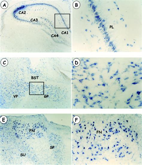 The Expression Of Ccn3 Nov RNA And Protein In The Rat Central Nervous System Is