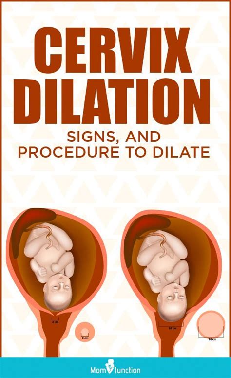 Cervix Dilation Chart Signs Stages And Procedure To Check Artofit