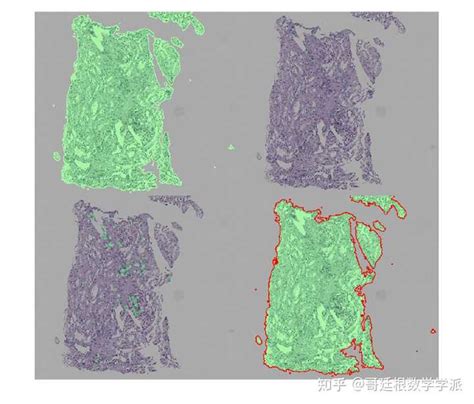 如何解释一下计算机视觉中的图像分割？ 知乎