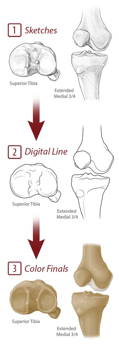 Workflow Thompson Medical Illustration