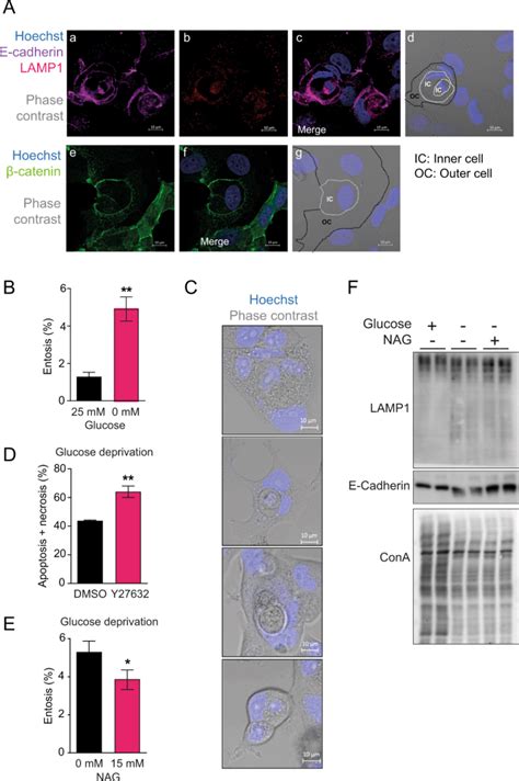 糖基化缺陷，被 Pepck M 抵消，驱动乳腺癌细胞的嵌顿 Cell Death And Disease X Mol