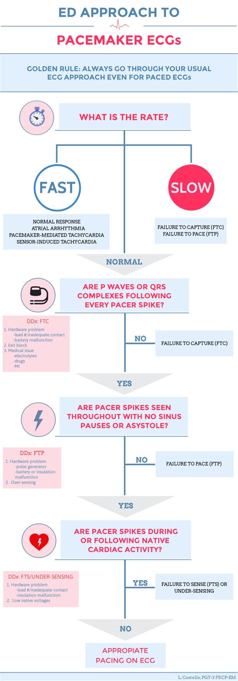 Pacemaker Essentials How To Interpret A Pacemaker Ecg Canadiem