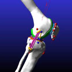 SimTK Open Knee S Virtual Biomechanical Representations Of The Knee Joint Project Home