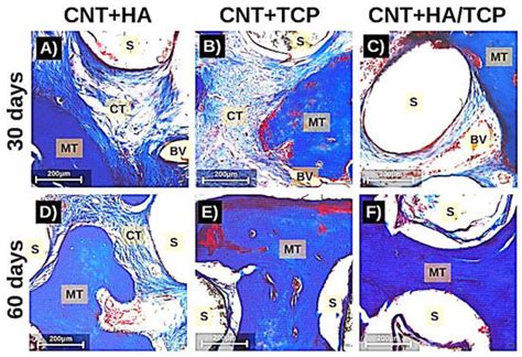 Early In Vivo Osteogenic And Inflammatory Response Of 3d Printed Polycaprolactonecarbon