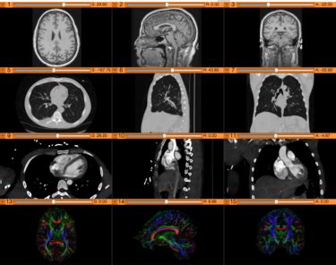 Documentation Nightly Training Slicer Wiki