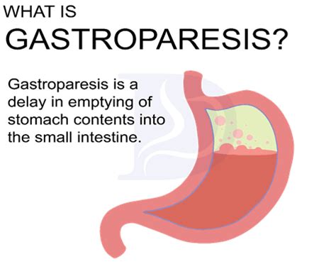 Gastroparesis Digestive And Liver Health Specialists