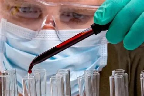 Myeloproliferative Disease Causes Symptoms Diagnosis Diseases And