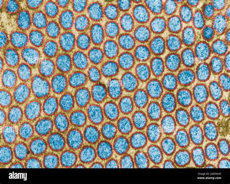 Coloured Transmission Electron Micrograph Tem Showing A Brush Or Striated Border In Cross