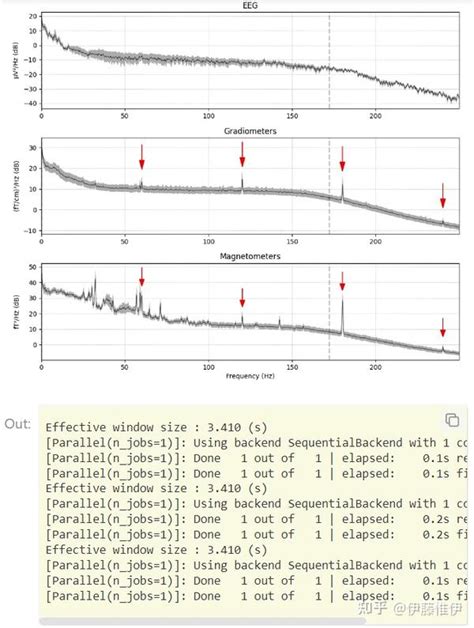 Preprocessing——artifact Detection 知乎