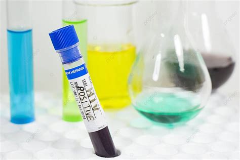 Immune Deficiency Background Images Hd Pictures And Wallpaper For Free