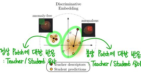 Knowledge Distillation 방식의 Anomaly Detection