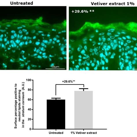 Ultrasound Image Of The Skin Epidermis Dermis Hypodermis Download