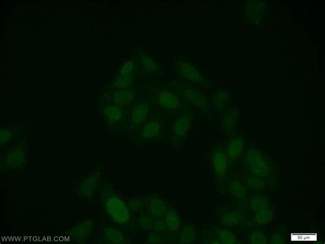 Runx1 Middle Antibody 25315 1 Ap Proteintech