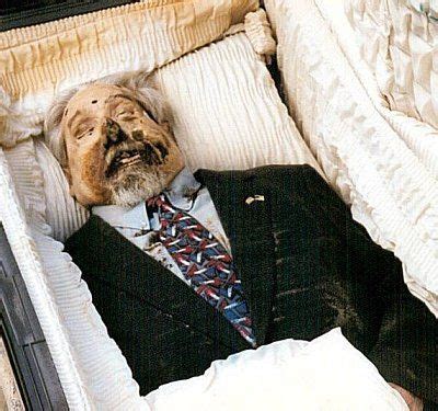 Pictures That Show Adipocere Grave Wax On Dead Bodies
